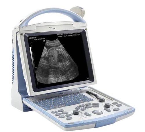 Jasa Pengujian dan Kalibrasi Alat Kesehatan USG 3D