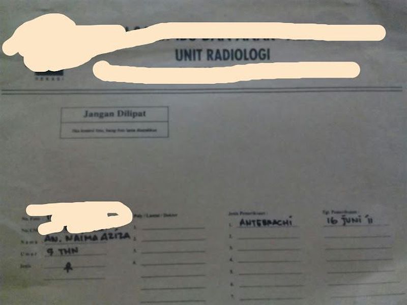 AMPLOP RONTGEN ANAK / AMPLOP RONTGEN DEWASA - RONTGEN ANAK