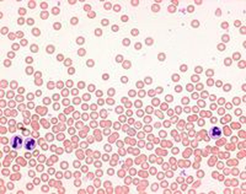 Hemacolor Staining Kits