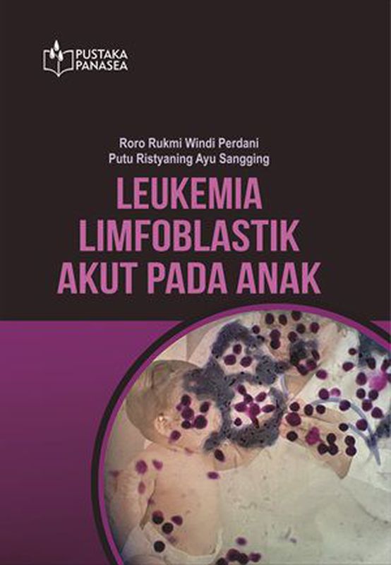 Leukemia Limfoblastik Akut Pada Anak
