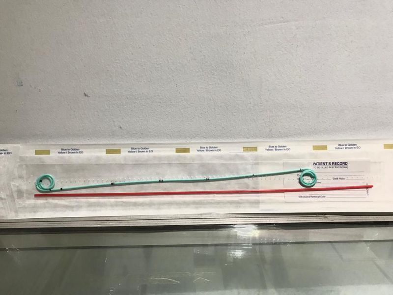 DJ STENT 6 OC TANPA WIRE SURGIMEDIK