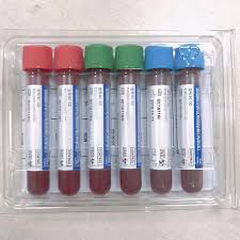 SFRI/MINDRAY CONTROL NORMAL