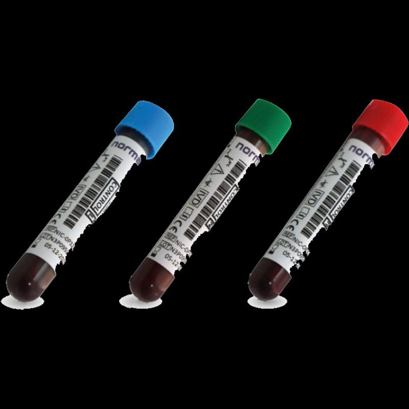 RAYTO CONTROL NORMAL UNTUK 5 DIFF