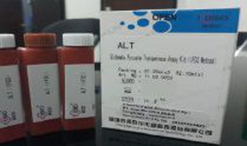 Reagen GPT ALAT (ALT) IFCC