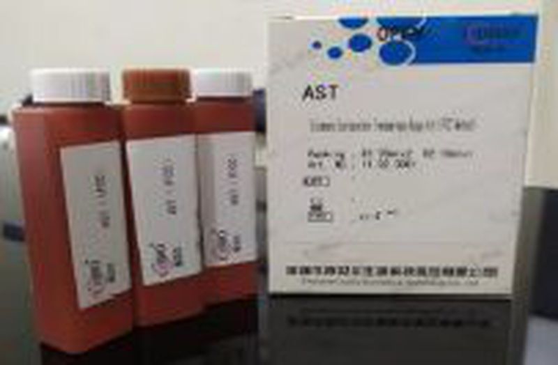 Reagen GOT ASAT (AST) IFCC