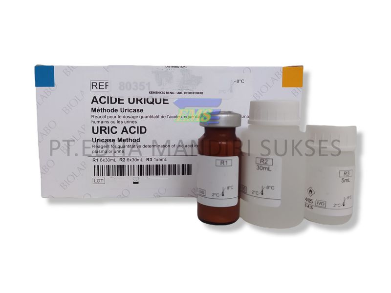 Uric Acid Uricase Method