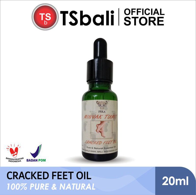 Cracked Feet Oil, Minyak Tumit -100% Pure & Natural Essential Oil
