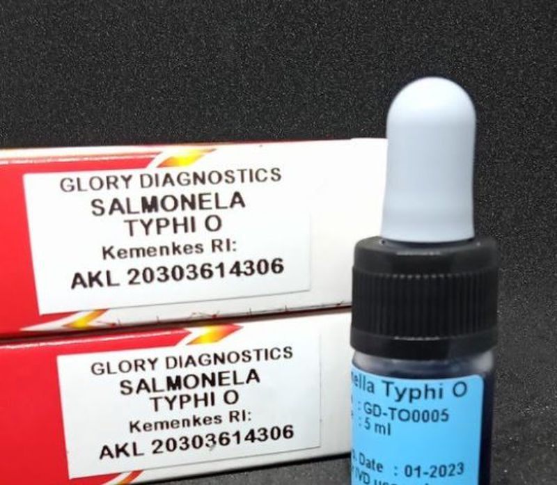 Reagen Widal Test Salmonella Typhi O