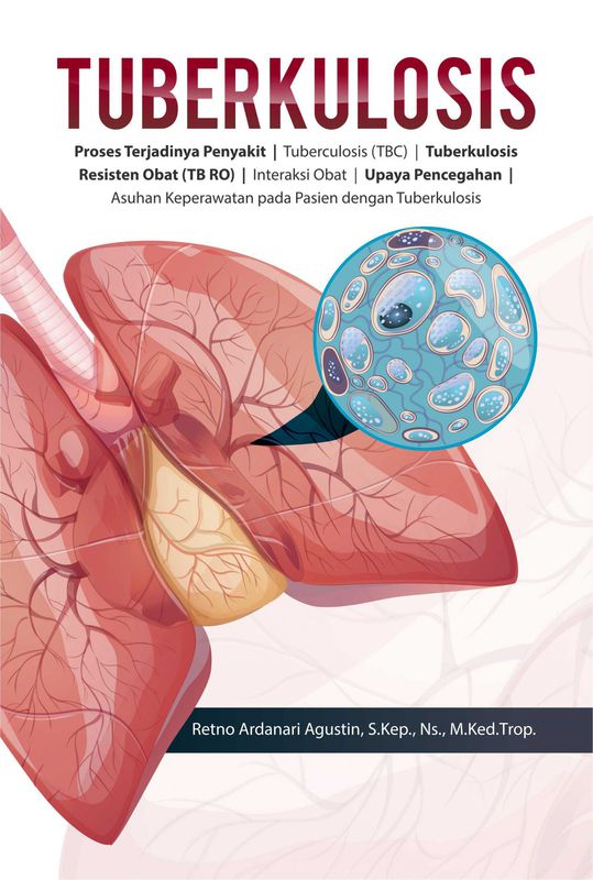 Buku Tuberkulosis