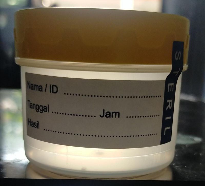 Pot Sputum / Pot Spesimen