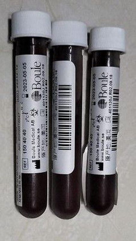 CONTROL- DIFF NORMAL 16 PARAM, 1 X4, 5 ML