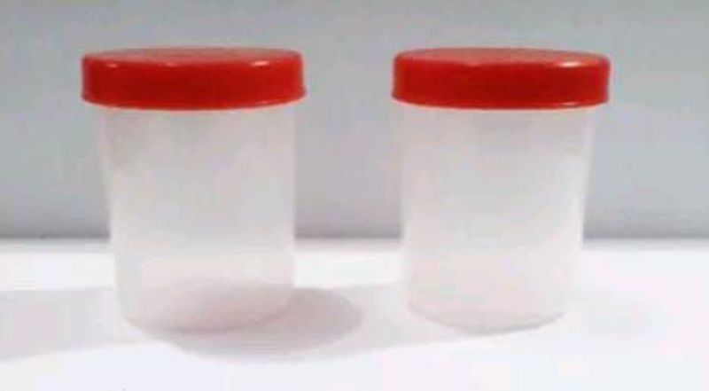 POT URIN / SPUTUM STERIL