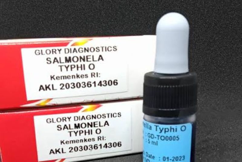 Reagen widal S. Typhi O Glory