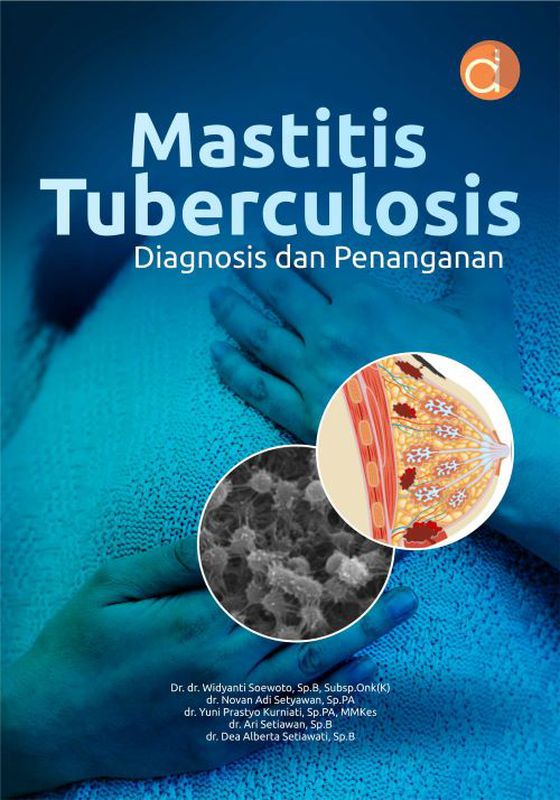 Mastitis Tuberculosis Diagnosis dan Penanganan