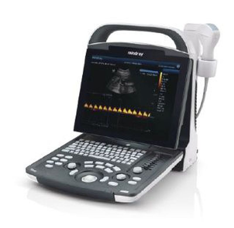 USG 2D Ultrasound Mindray DP-10 + Printer USG Sony
